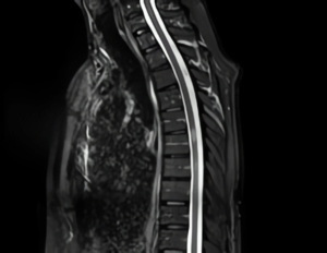 Les examens - IRM des Sources