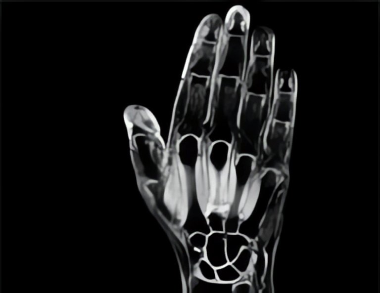 IRM de la main - IRM des Sources